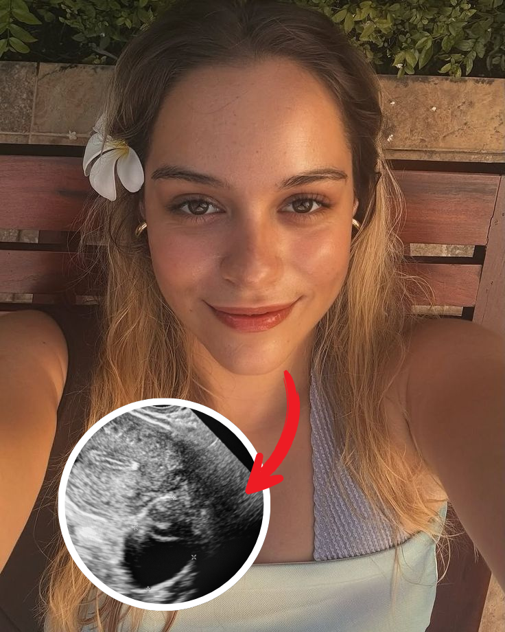 Shocking: Actress Hailey Pinto is pregnant, the child is from Home And Away actor, he is 10 ...